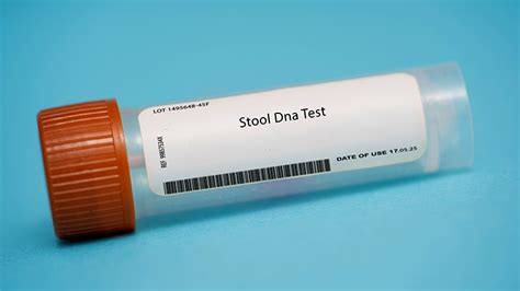 Molecular Stool Testing Could Cut Colonoscopies By 15 41