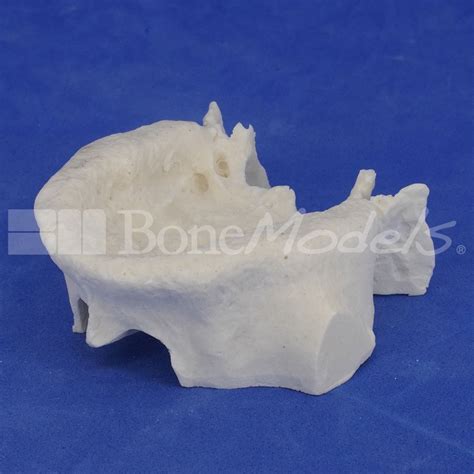 U 023abcsf1 Maxillary Model For Implant Placement Bonemodels Slu