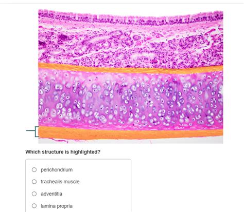 Solved Which Structure Is Highlighted Perichondrium
