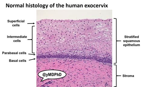Endocervix Histology