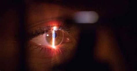 Ai Can Now Diagnose Retinal Inherited Diseases In Eye Scans Dh Latest News Dh News Latest