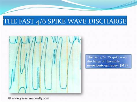 Issues In Brainmapping The Secrets Of Conventional Eeg Pptx Brain And Nervous System