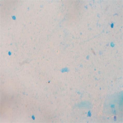 tb bacilli detection object detection dataset by praneeth