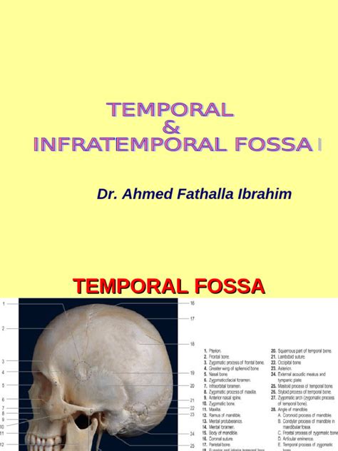 13 Temporal And Infratemporal Fossa I Pdf Musculoskeletal System