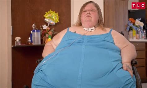 A 700 Lb Woman Lost 440 Lbs Achieving A Stunning Transformation