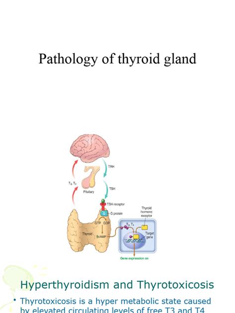 Thyroid Gland Pathology Final Pdf Thyroid Hyperthyroidism