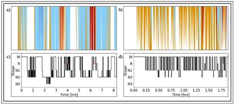 Multimodal Neural Network Analysis Of Single Night Sleep Stages For Screening Obstructive Sleep