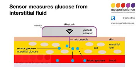 Are Continuous Glucose Monitors Cgms Accurate