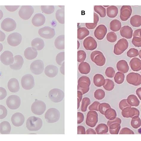Platelets Glycoprotein Expression Of Flow Cytometry Download Scientific Diagram