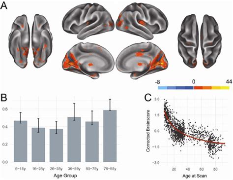 Structural Covariance Of The Visual Network A The Spatial Pattern