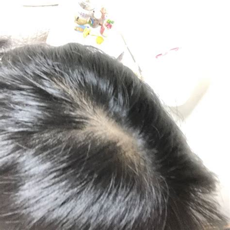 쌍가마 인데 정수리 탈모같지 인스티즈 Instiz 일상 카테고리