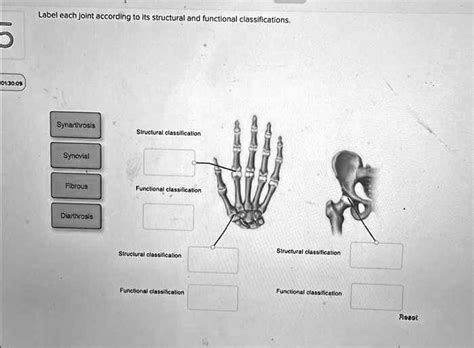 Solved Label Each Joint According To Its Structural And Functional