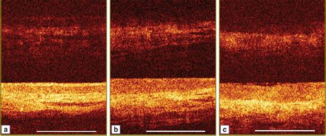 Figure 1 From The Use Of Cross Polarization Oct In Determining The Dynamics Of The State Of