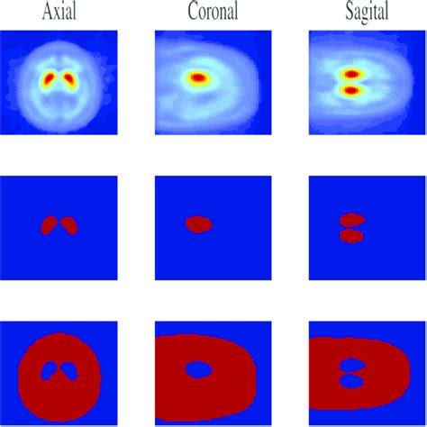The Computed Template And The Different Masks Used In The Intensity