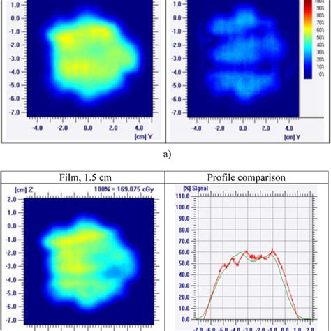dose comparison of film measurement and tps calculation for the lamb