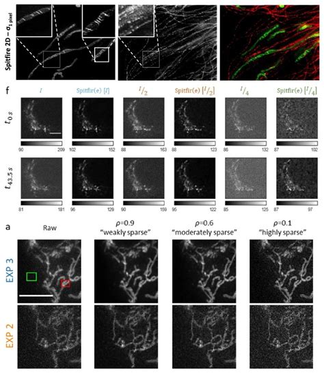 Behzad Amanpour On Linkedin Machinelearning Python Radiology Imageprocessing Radiomics