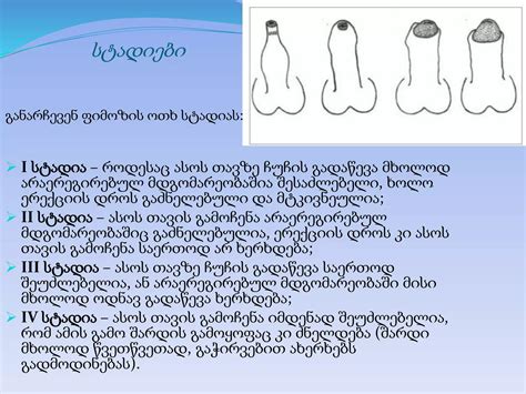 Presentation1pptx Presentation1pptx