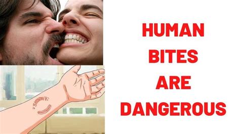 Can A Human Bite Kill You Understanding The Dangers And Risks