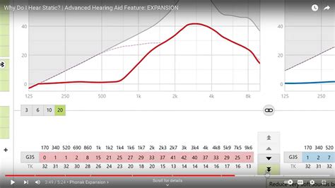 Phonak Target Expansion To Reduce Hissing Hearing Aid Self Fitting And Adjusting Diy