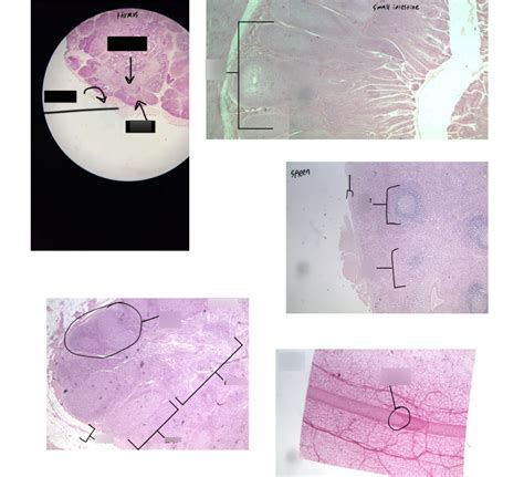 Histology Of The Lymphatic System Flashcards Quizlet My Xxx Hot Girl