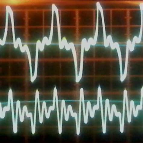 oscillogram of a periodic voltage pulse upper and current lower