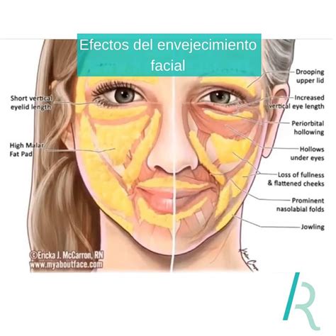 Este Esquema Representa Los Clínica Dra Anna Roca