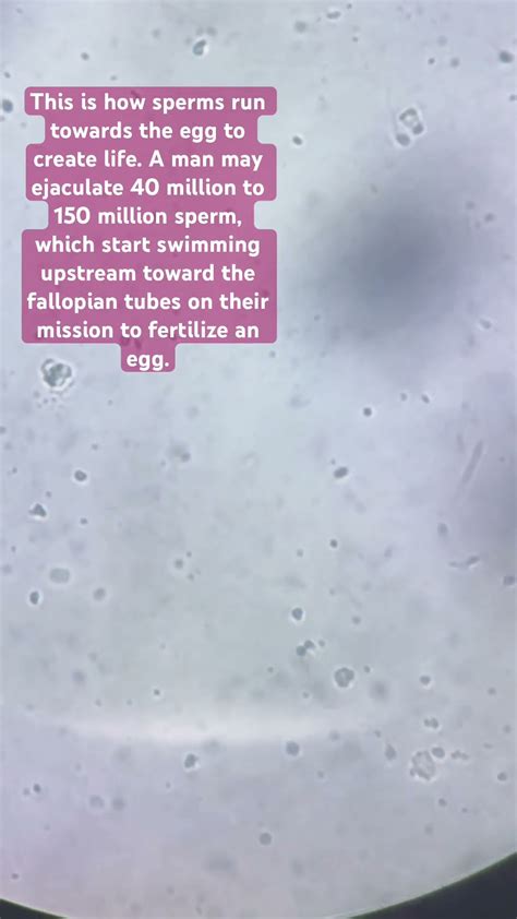 Sperm Count And Men Fertility Pathology YouTube