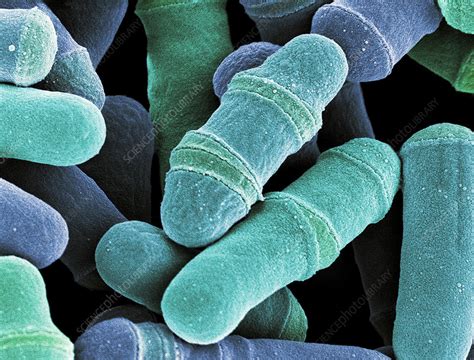 Dividing Yeast Cells Sem Stock Image B2501551 Science Photo Library