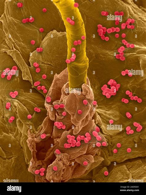 Coloured Scanning Electron Micrograph Sem Of Photocomposite Coloured Scanning Electron Micrograph Sem Of Photocomposite