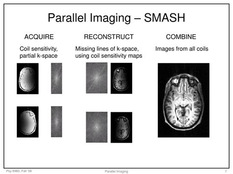Ppt Parallel Imaging Powerpoint Presentation Free Download Id 1298946