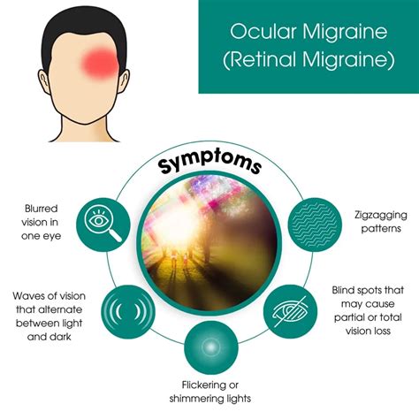 Ocular Migraine Simulation