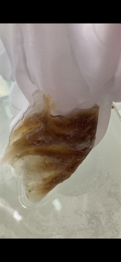 Weird Blob Found In Curtain Knot R Whatisthis