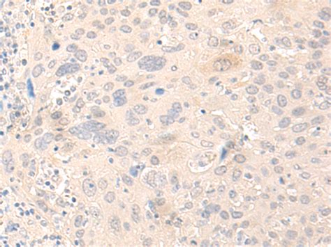 兔抗nlrx1多克隆抗体anti Nlrx1 Rabbit Polyclonal Antibody 生命科学产品与技术服务 生工生物工程