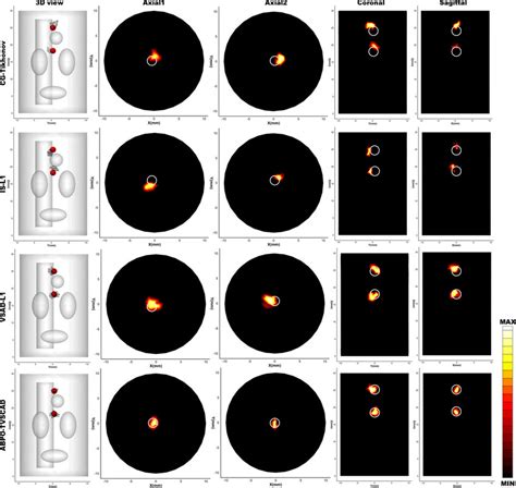 Reconstruction Results Of Different Methods For Dual Source The Real Download Scientific