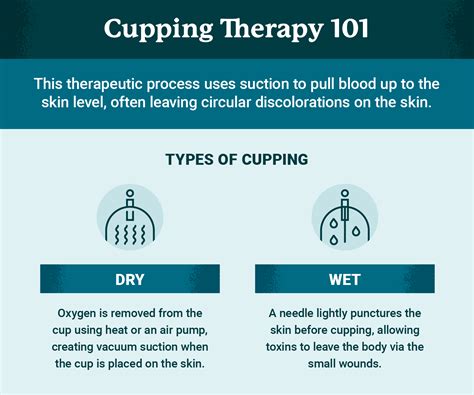 Cupping Therapy Research Articles Karlykruwyu