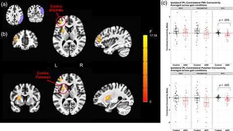 results of the visuomotor‐dependent connectivity analysis corrected