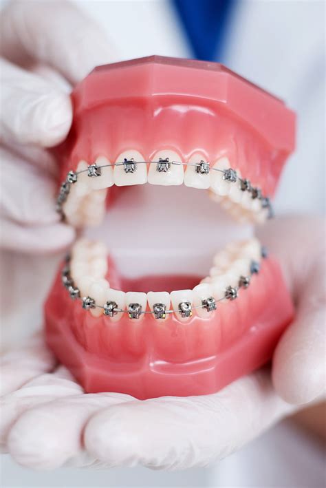 Metal Braces Treatment Traditional Orthodontics By Dr Gilbert