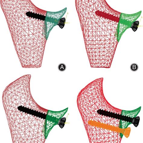 Af Screw‐cancellous Bone Rotation Torque Of Finite Element Fe