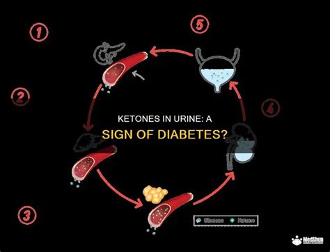 Ketones In Urine A Sign Of Diabetes Medshun
