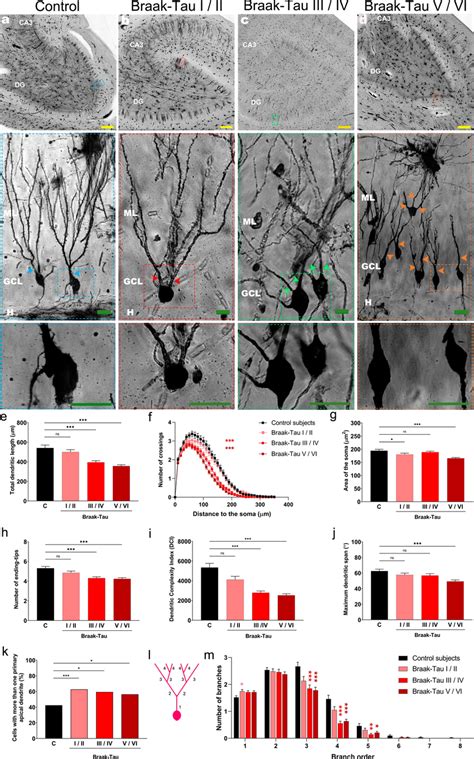 Morphological Alterations Of Human Dentate Granule Cells Dgcs During Download Scientific
