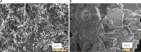 Field Emission Scanning Electron Micrograph Fesem Of A Suspension Of