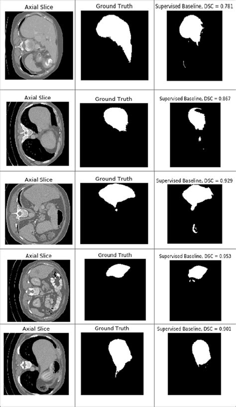 Graphical Plots For Model Loss And Model Score Based On The Training Download Scientific