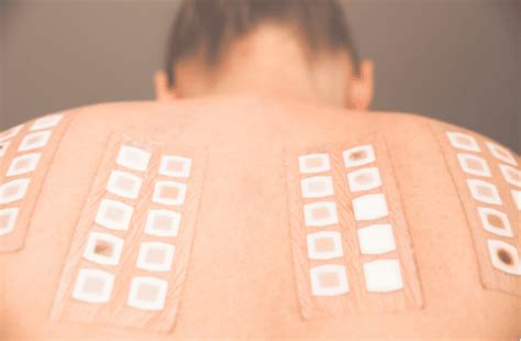 how does patch testing work