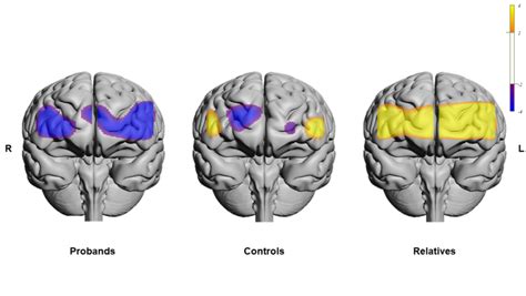 Patterns Of Prefrontal Cortex Activation During Response Inhibition On