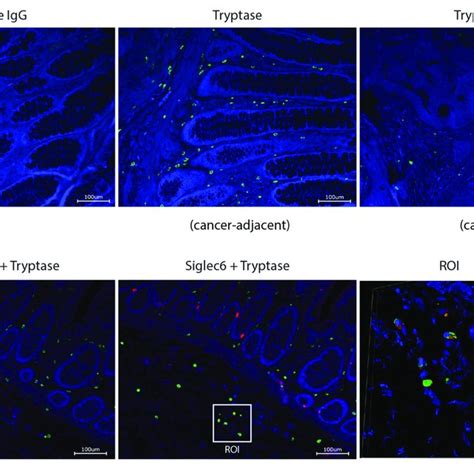 Ligands For Siglec 6 In Human Crc Tissues Lectin Download