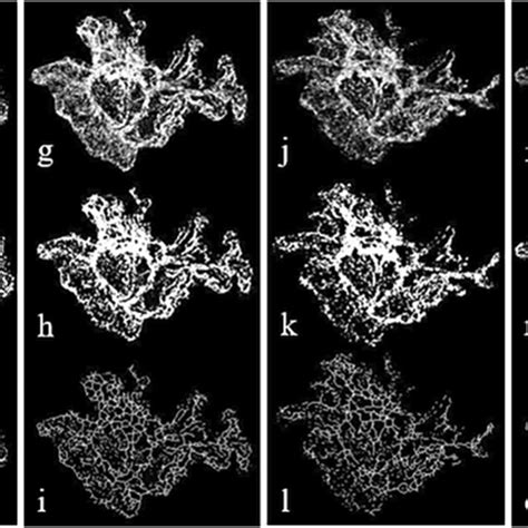 Analysis Of A Series Of Swept Source Optical Coherence Tomography Download Scientific Diagram