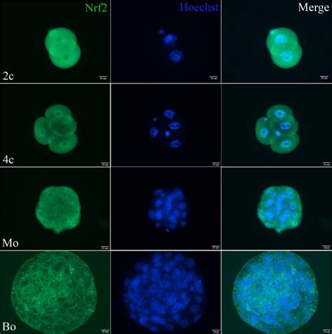 The Subcellular Localization Of Nrf2 During Mouse Embryo Development