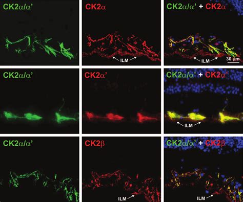 Human Retinal Astrocytes Express ␣ ␣ Ј And ␤ Subunits Of Ck2 Only Download Scientific
