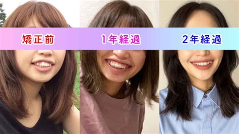 歯列矯正｜まいにちみどりブログ