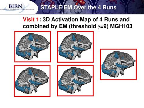 Ppt Fbirn Human Phantom” Reproducibility Analysis Powerpoint
